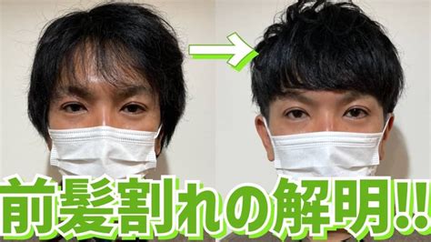 前髪が割れてしまう理由を解析 RELIVE 薄毛に悩む男性のための完全個室美容室