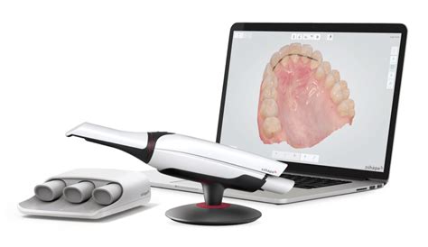 3Shape TRIOS 4 Intraoral Scanner