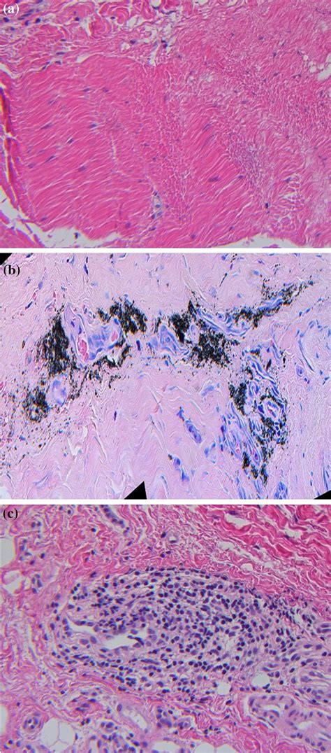 Dense Fibrous Connective Tissue Diagram