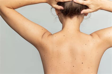 Áreas Dermatológicas SBD