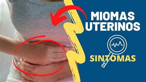 MIOMAS UTERINOS Síntomas Medicina en la Red YouTube