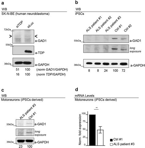 The Dysregulation Of Gad1 Is Conserved In Human Cell Lines And IPSCs