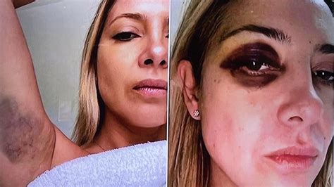 Nuevas filtraciones las fotos de Fabiola Yañez golpeada y más chats