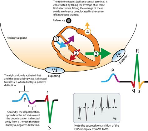 ECG Interpretation Characteristics Of The Normal ECG P Wave QRS