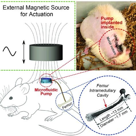 Working Principles Of The Wireless Battery Less Implantable