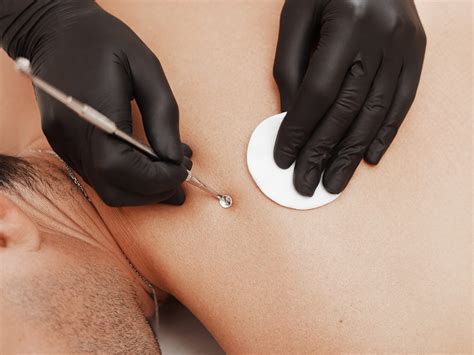 LIMPIEZA PROFUNDA DE ESPALDA PARA PIELES GRASAS Y PUNTOS NEGROS 80min