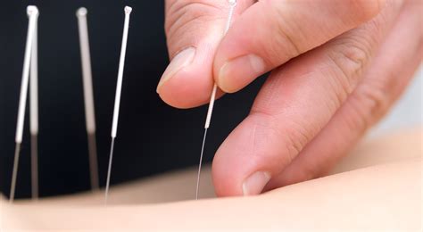 Medicina tradicional chinesa Acupuntura Espaço Saúde FCiências