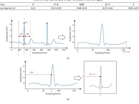 table 1 from arrhythmia classification algorithm based on a two dimensional image and modified