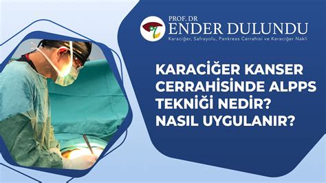 Karaciğer Kanser Cerrahisinde ALPPS tekniği nedir Nasıl uygulanır I