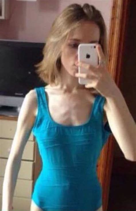 Skinny Anorexic Nude Girl