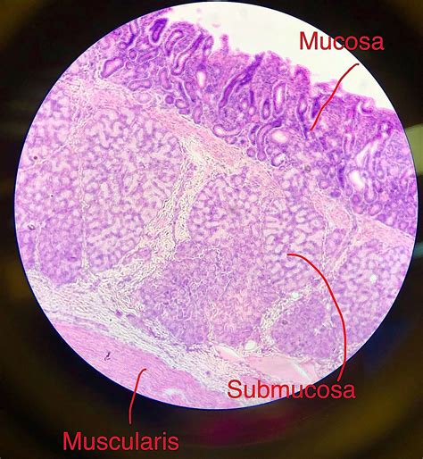 Duodenum Histology