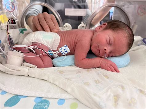 Positioning Babies In Critical Care Dandlelion Medical