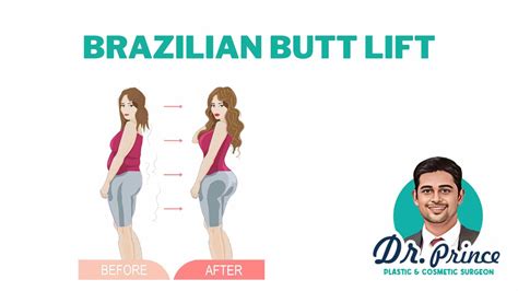 The Art Of Curves Comprehensive Guide To Brazilian Butt Lift BBL