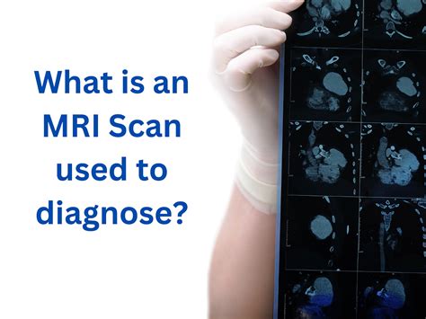 What Is An MRI Scan Used To Diagnose Understanding Its Diagnostic