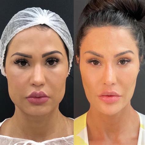 Gracyanne Barbosa Antes E Depois