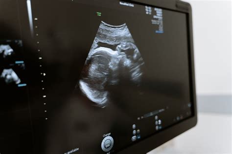 Wie putze ich Zähne richtig mit einer Ultraschall Zahnbürste Tipps
