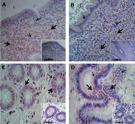 Expresi ó n inmunohistoqu í mica del RP en endometrio de ovejas con