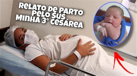 Relato de parto cesárea pelo SUS 3 Cesárea YouTube