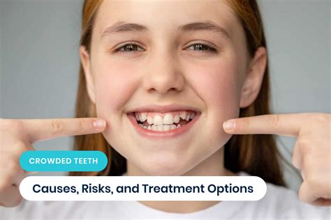 Causes Of Crowded Teeth And How You Can Straighten Them
