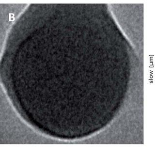 Platelet Aggregation Microscopic Images Of Drug Loaded Naked Surface