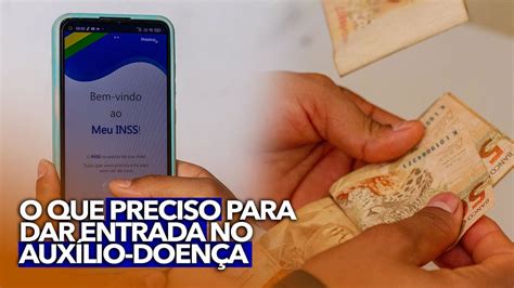 O que preciso para dar entrada no Auxílio doença do INSS Quais doenças