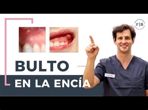 Tengo un bulto en la encía Descubre qué lo causa y cómo remediarlo de