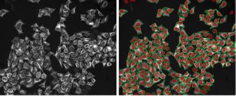 20 examples of effortless nucleus and cell segmentation using pretrained deep learning models