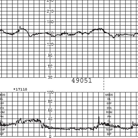 pdf fetal monitoring