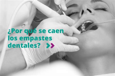 Por qué se cae un empaste dental Clínica dental en Pedrera