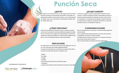 Técnica de Punción Seca Qué es y utilidades FisioOnline