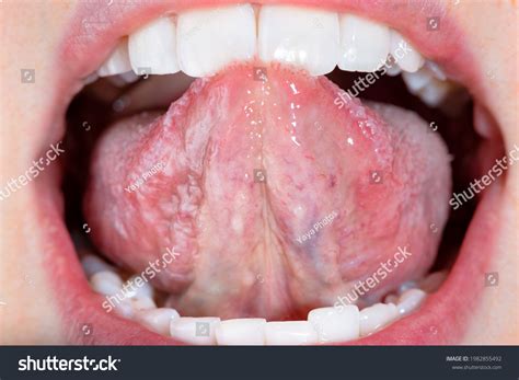 Under Tongue Over 3 544 Royalty Free Licensable Stock Photos
