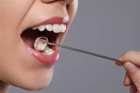 Qué es la piorrea o enfermedad periodontal Clínica Dental Plaza
