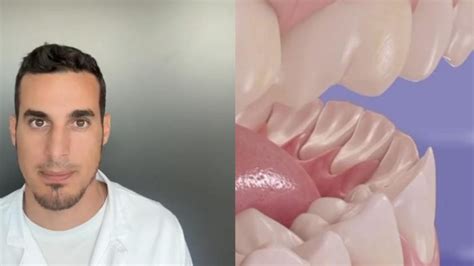 Soy odontólogo y te aclaro si después de cepillarte los dientes debes
