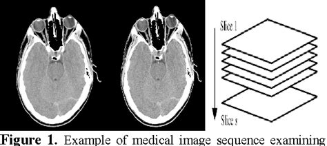 figure 1 from gpu acceleration of 2d dwt image compression in matlab with cuda semantic scholar
