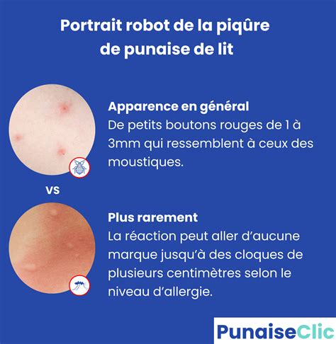 Punaises de lit Les symptômes bénins les complications et leur prise