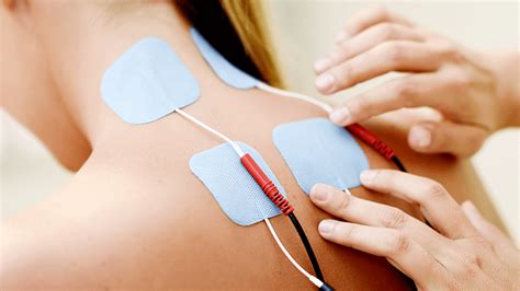 Electroterapia En Fisioterapia Definici N Y Beneficios Drfisio