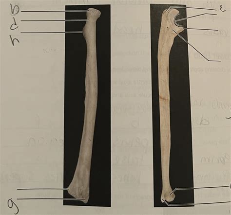 Anatomy Lab Practical 2 Diagram Quizlet