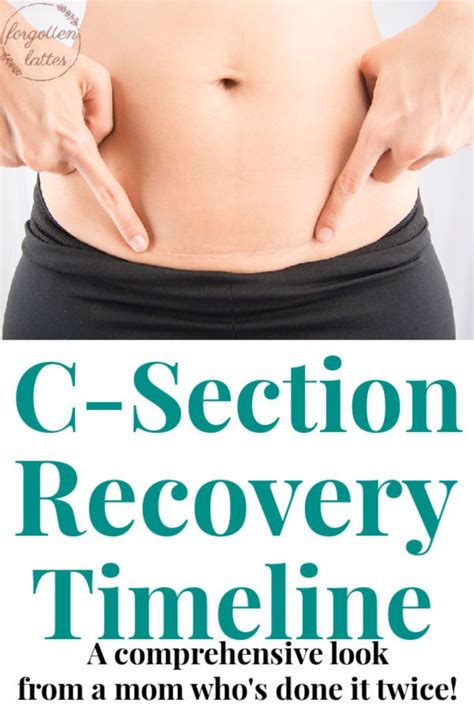 C Section Recovery Timeline A Week By Week Look At Recovery Forgotten Lattes C Section