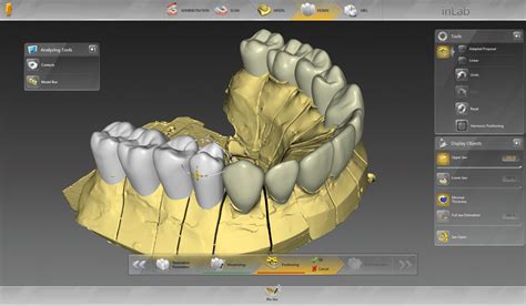 Software inLab Software odontológico CAD Dentsply Sirona Brasil