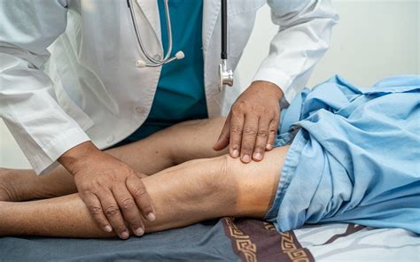 Recovery Tips Post Robotic Knee Replacement Surgery