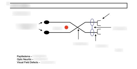 Cn Ii Optic Nerve Diagram Quizlet