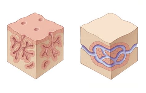 Bms Glands D Flashcards Quizlet