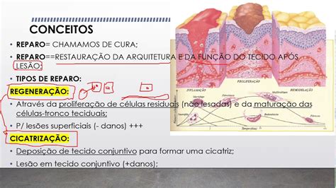 Patologia Geral Reparo Tecidual Celular YouTube