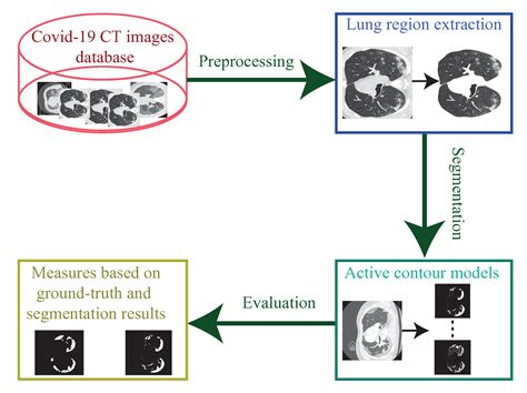 Applied Sciences Free Full Text COVID 19 Lesion Segmentation Using
