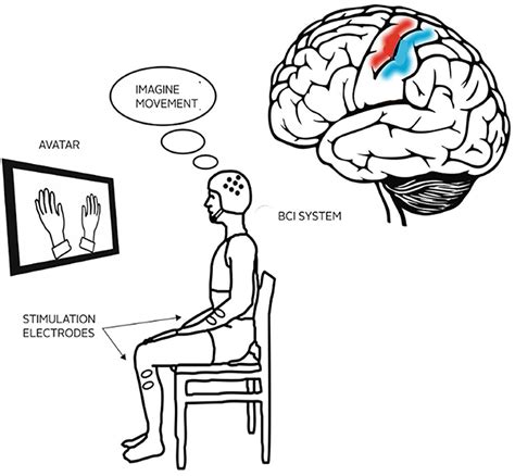How Can We Train The Brain To Help Stroke Patients Gtec Medical Engineering Gmbh