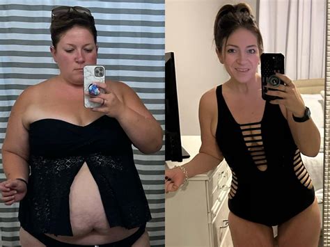 Before And After Semaglutide 6 People On The Game Changer Weight