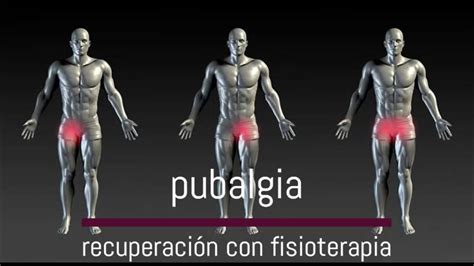 Pubalgia lesión de deportistas Resobert Medicina Radiología