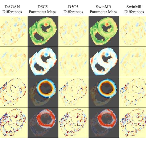 diffusion parameter maps of the reconstruction results af ×2 and the download scientific