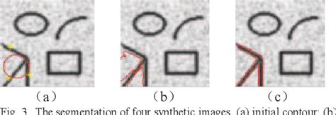 an improved model for image selective segmentation based on local and global statistics