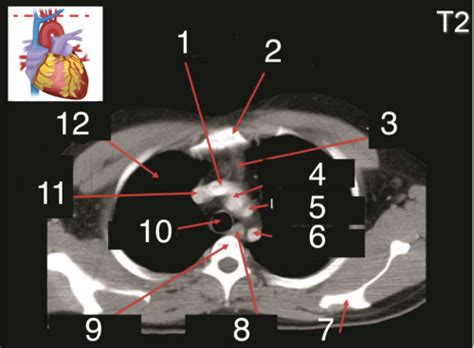 Cross Sectional Anatomy Flashcards Quizlet